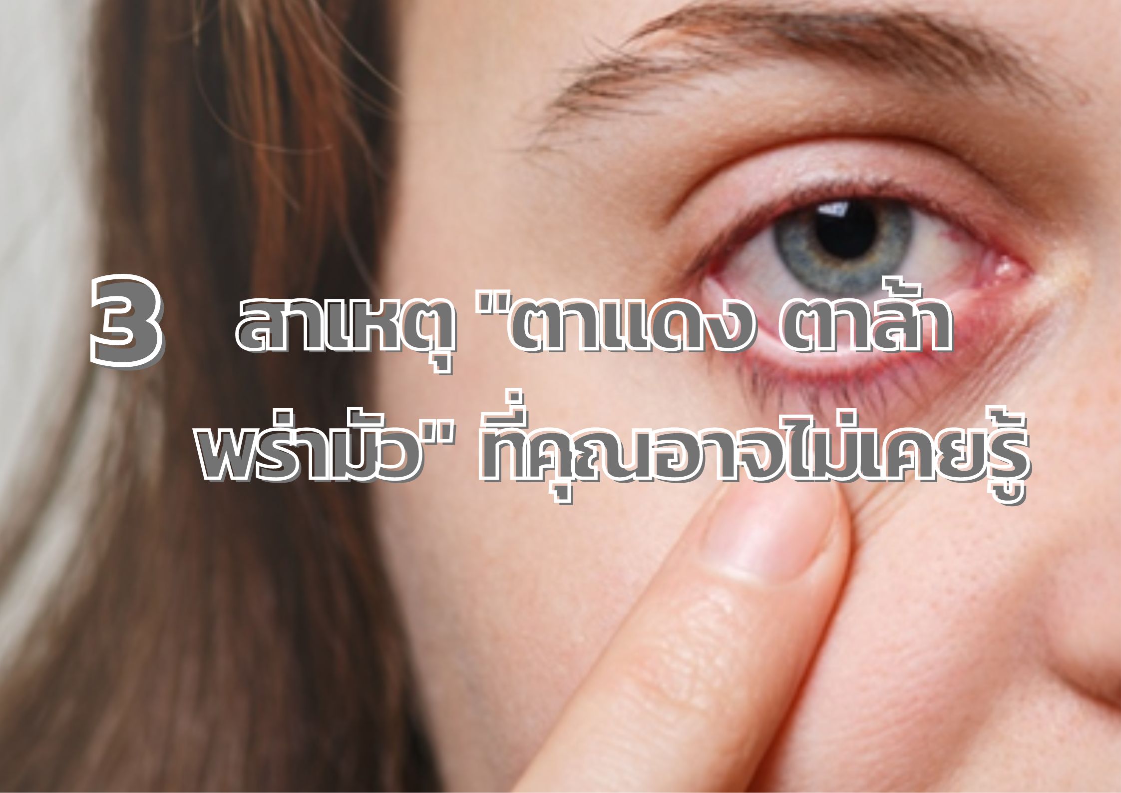 3 สาเหตุ ตาแดง ตาล้า พร่ามัว - ArapapaShop